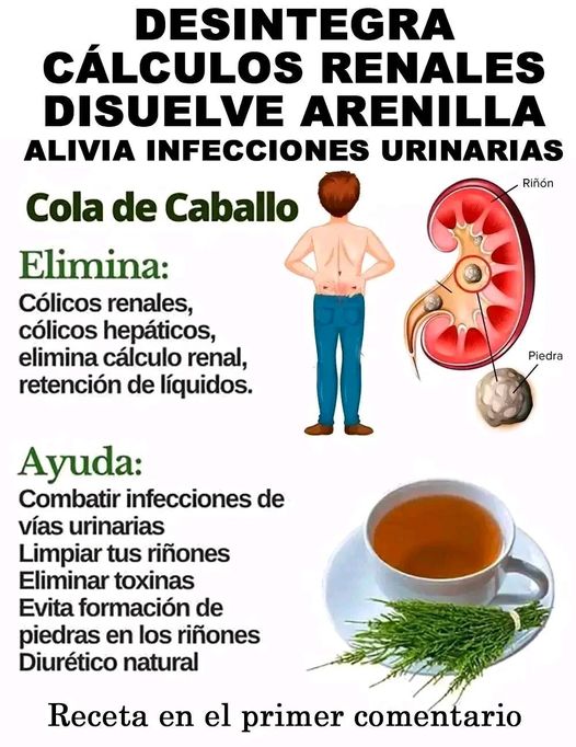 Remedio para expulsar los cálculos renales - Natureview